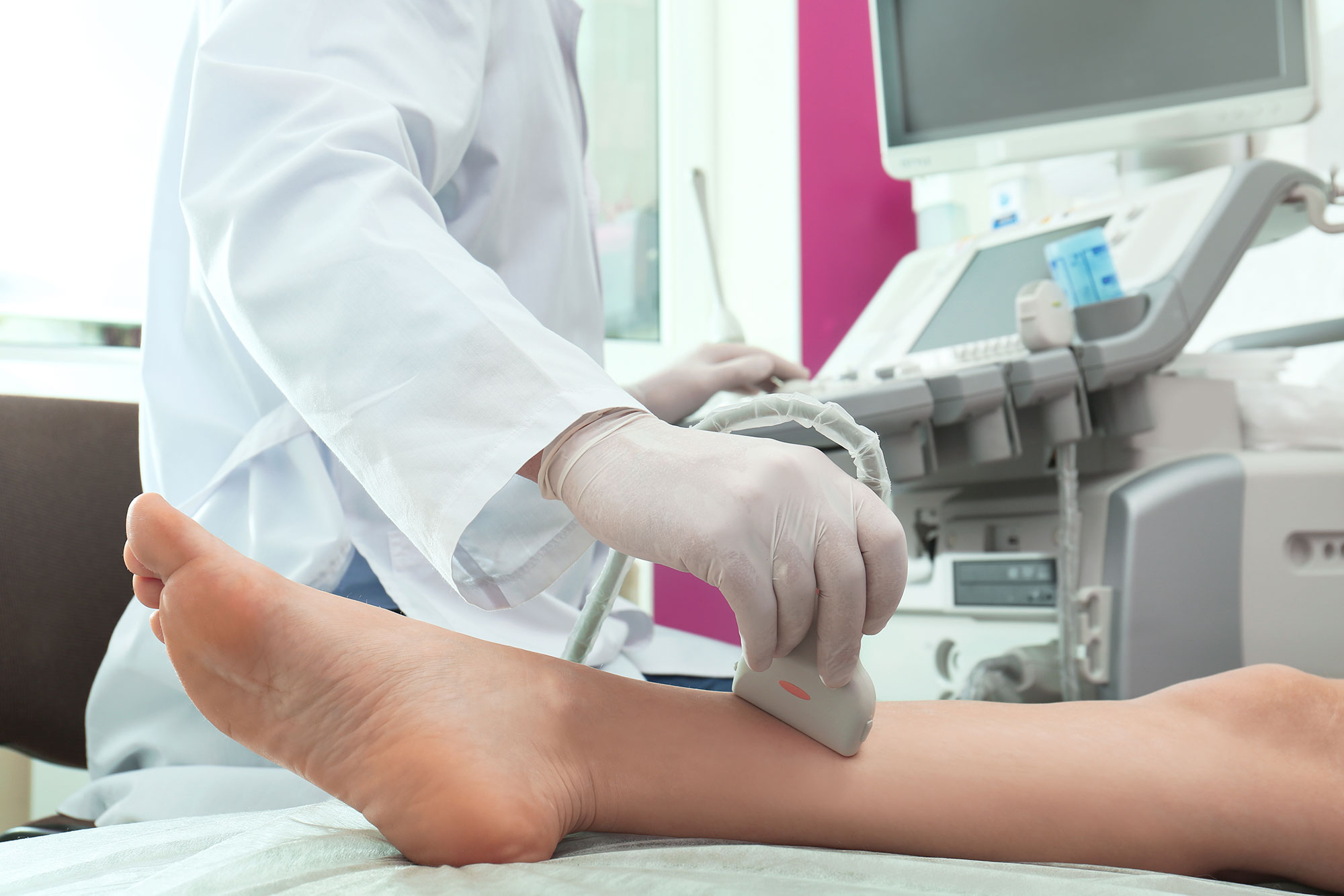 Lower Extremity Artery Duplex Ultrasound Springfield Arlington VA